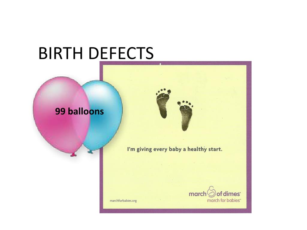 PPT - BIRTH DEFECTS PowerPoint Presentation, free download - ID:2926843