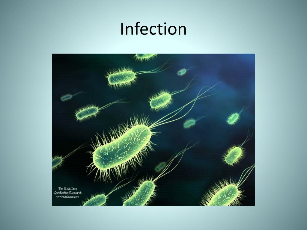 PPT - Infection PowerPoint Presentation, free download - ID:2928336