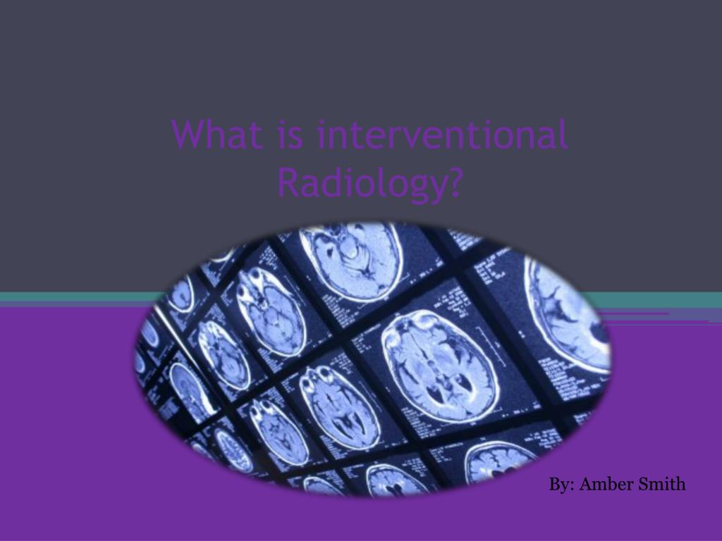 PPT - What is interventional Radiology? PowerPoint Presentation, free ...