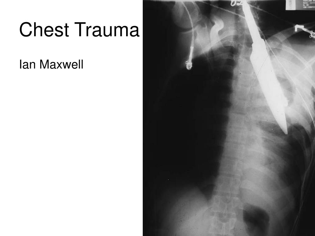 PPT - Chest Trauma PowerPoint Presentation, free download - ID:2970244