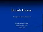 PPT - Leg Ulcers PowerPoint Presentation, free download - ID:282856