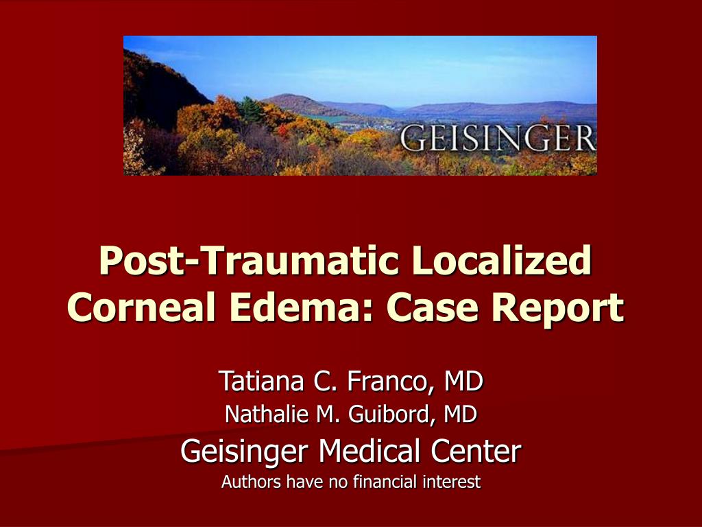 PPT - Post-Traumatic Localized Corneal Edema: Case Report PowerPoint ...