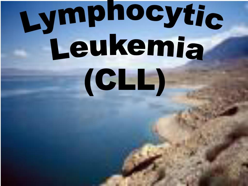 PPT - Chronic Lymphocytic Leukemia (CLL) PowerPoint Presentation, free ...