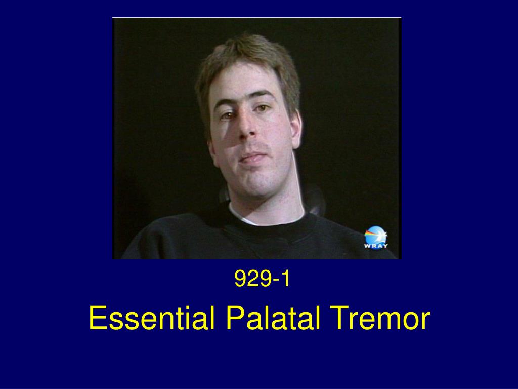PPT - Essential Palatal Tremor PowerPoint Presentation, free download ...