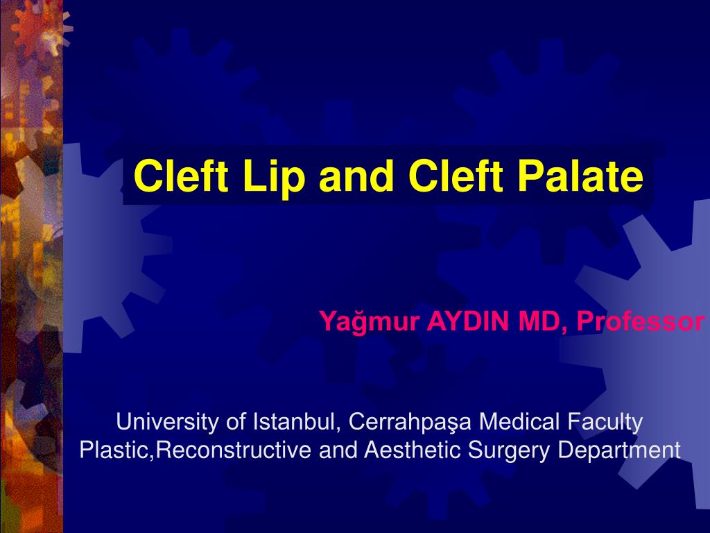 PPT - Cleft Lip and Cleft Palate PowerPoint Presentation, free download ...