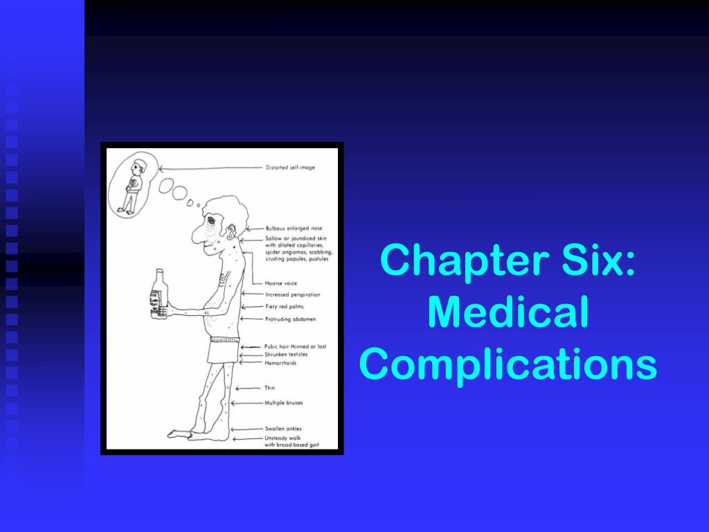 PPT - Chapter Six: Medical Complications PowerPoint Presentation, free ...