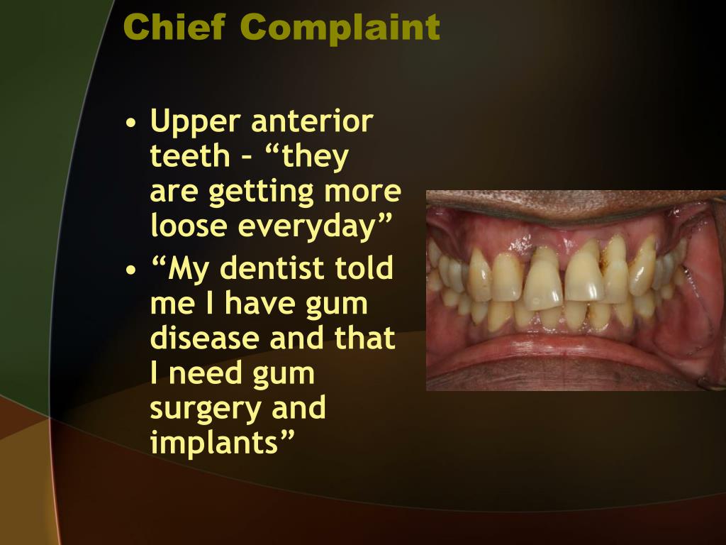 PPT - Chief Complaint PowerPoint Presentation, free download - ID:3039842