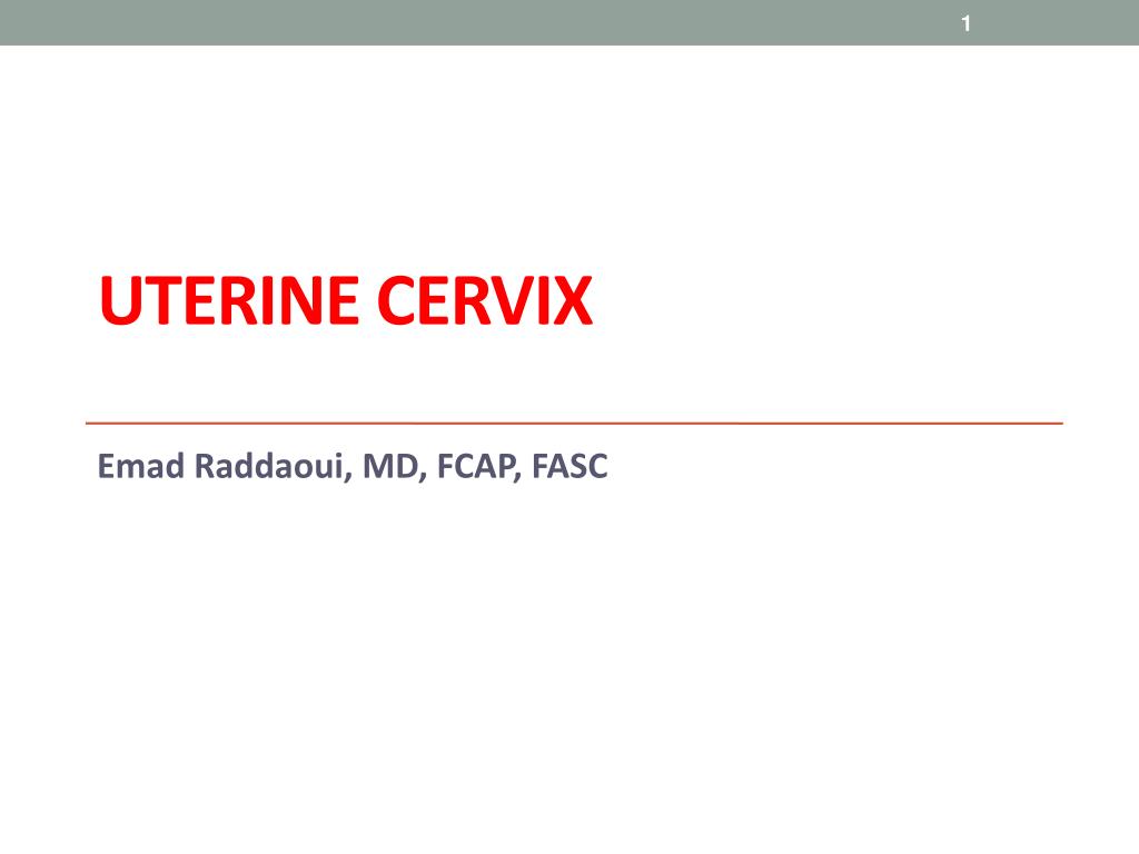 PPT - Uterine Cervix PowerPoint Presentation, free download - ID:3062948