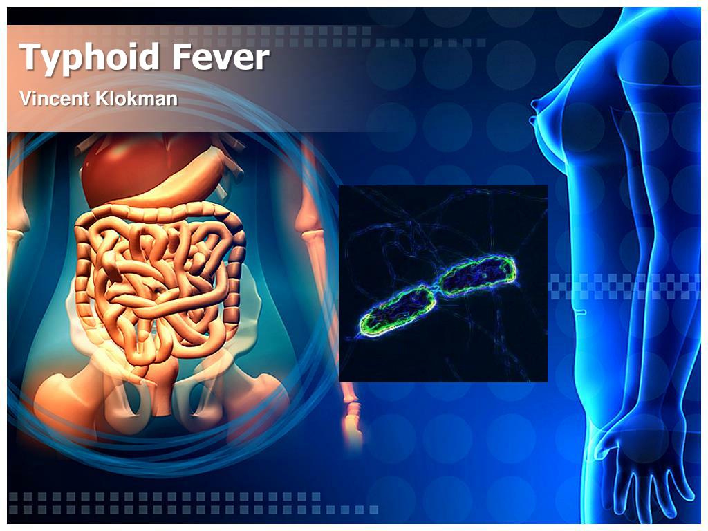 PPT - Typhoid Fever PowerPoint Presentation, free download - ID:3065958