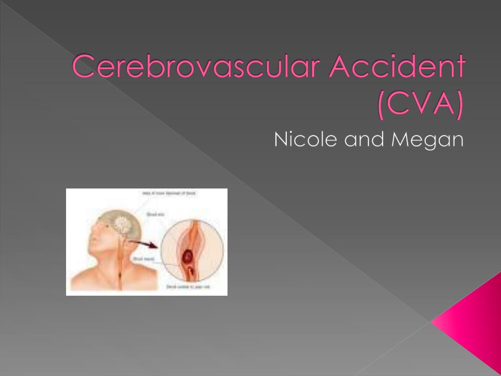 PPT - Cerebrovascular Accident (CVA) PowerPoint Presentation, free ...
