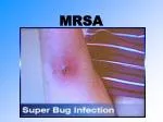PPT - MRSA PowerPoint Presentation, free download - ID:1182214
