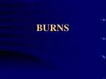 PPT - Burns PowerPoint Presentation, free download - ID:2358828