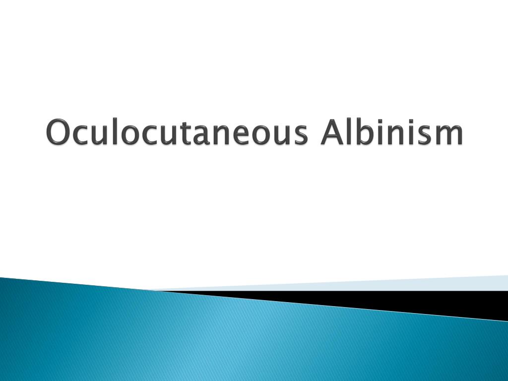 PPT - Oculocutaneous Albinism PowerPoint Presentation, free download ...