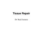PPT - Tissue Healing and Repair PowerPoint Presentation, free download ...