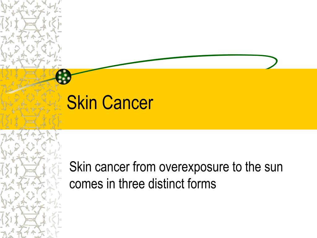 PPT - Skin Cancer PowerPoint Presentation, free download - ID:3126899