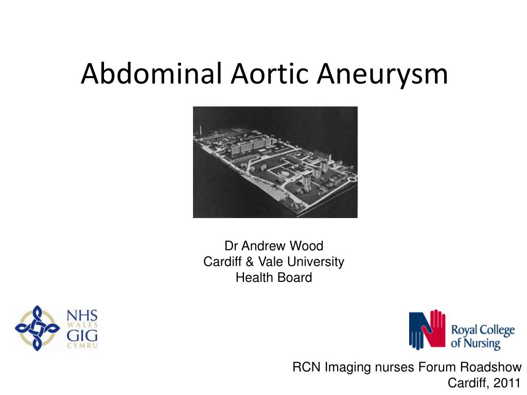 PPT - Abdominal Aortic Aneurysm PowerPoint Presentation, free download ...