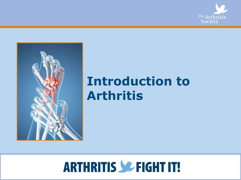 PPT - Introduction to Arthritis PowerPoint Presentation, free download ...
