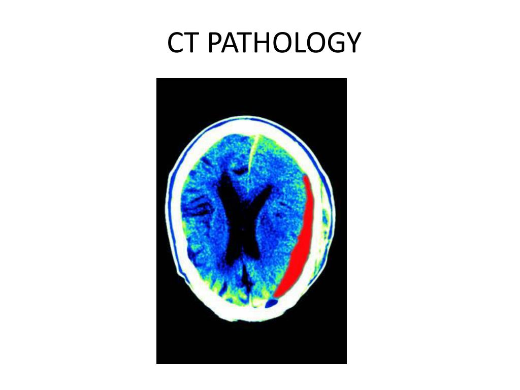 PPT - CT PATHOLOGY PowerPoint Presentation, free download - ID:3198625
