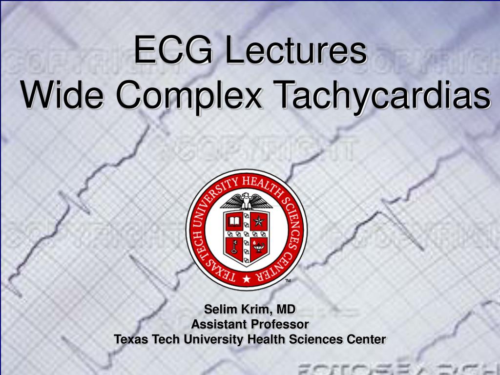 PPT - ECG Lectures Wide Complex Tachycardias Selim Krim, MD Assistant ...