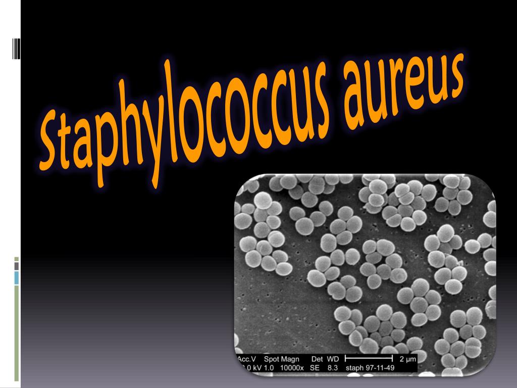 PPT - Staphylococcus aureus PowerPoint Presentation, free download - ID ...