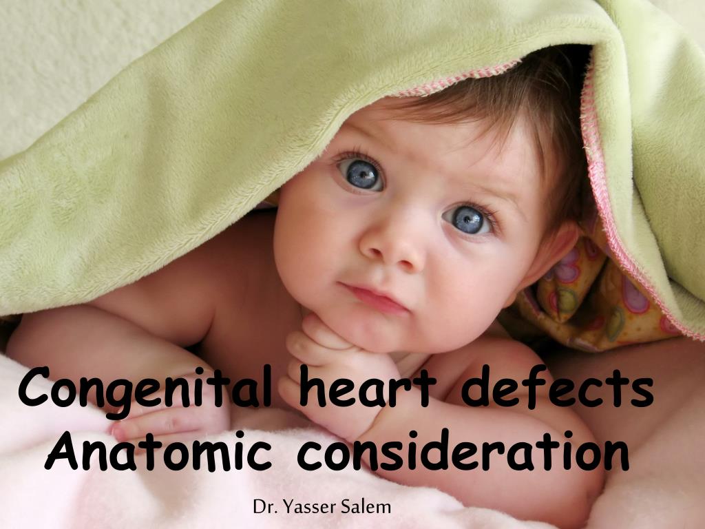 PPT - Congenital heart defects Anatomic consideration PowerPoint ...
