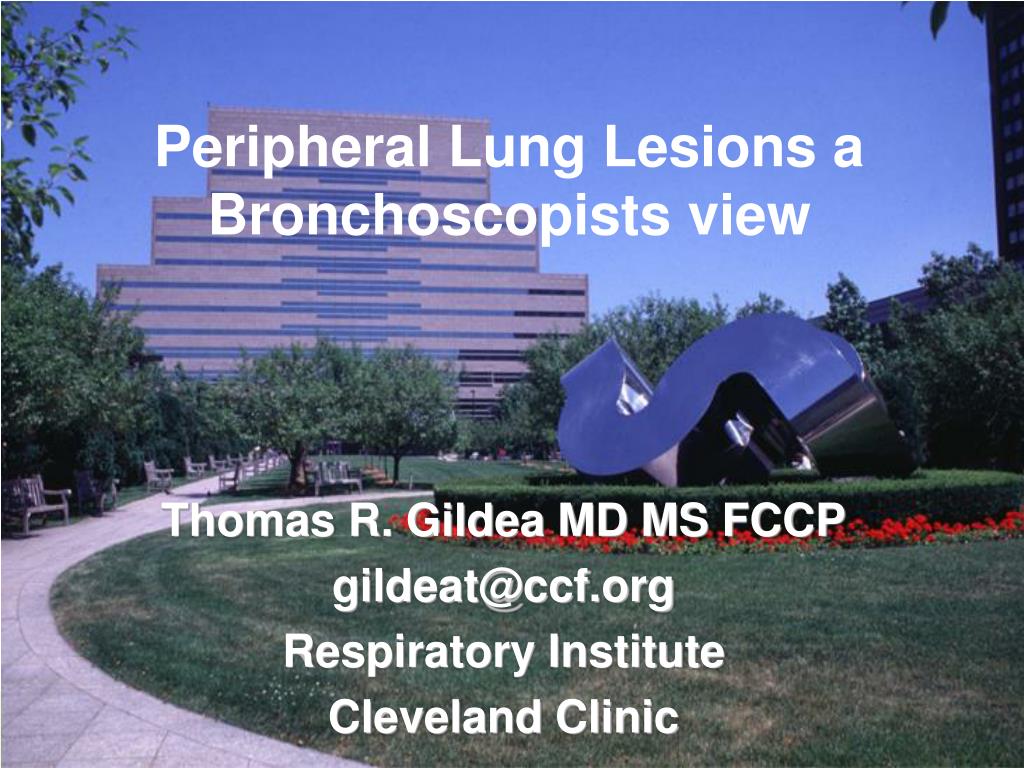 PPT - Peripheral Lung Lesions a Bronchoscopists view PowerPoint ...