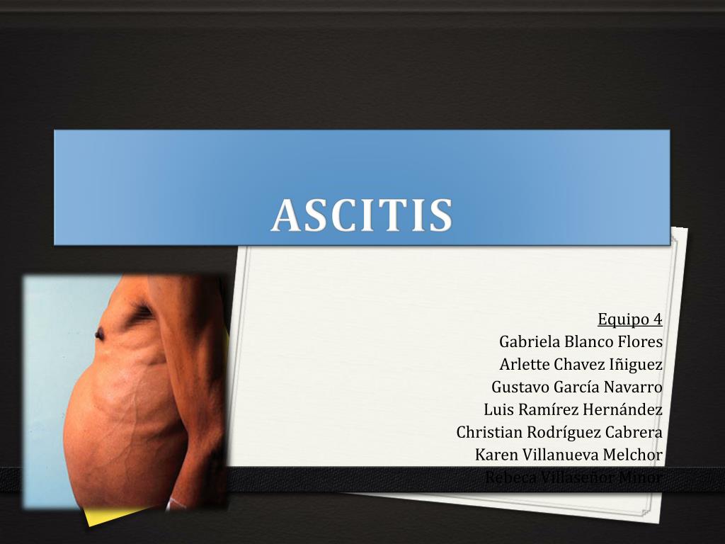 PPT - ASCITIS PowerPoint Presentation, free download - ID:3447695