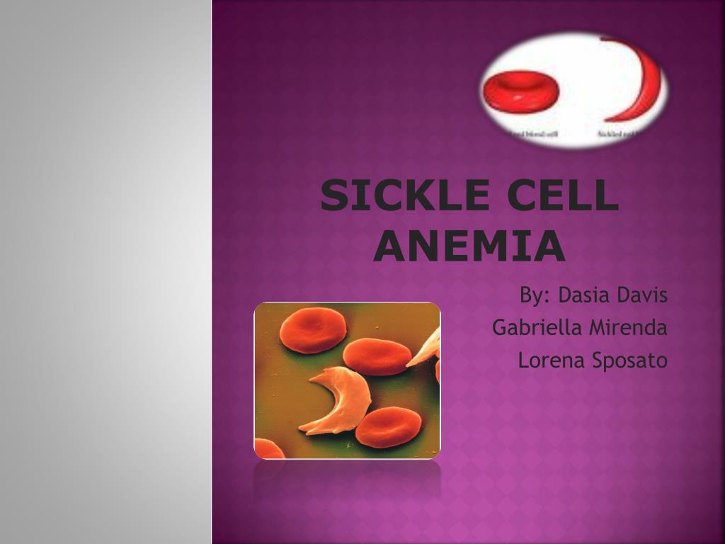 PPT - Sickle Cell Anemia PowerPoint Presentation, free download - ID ...