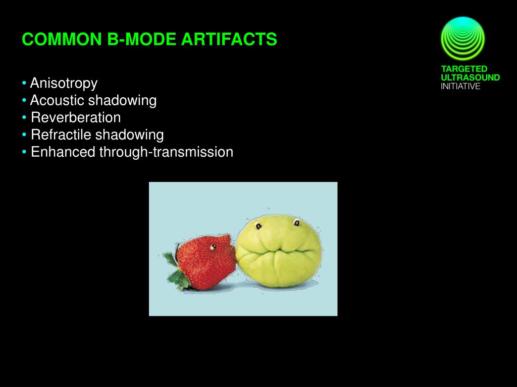 PPT - Common B-MODE ARTIFACTS PowerPoint Presentation, free download ...