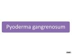 PPT - Pyoderma gangrenosum PowerPoint Presentation, free download - ID ...