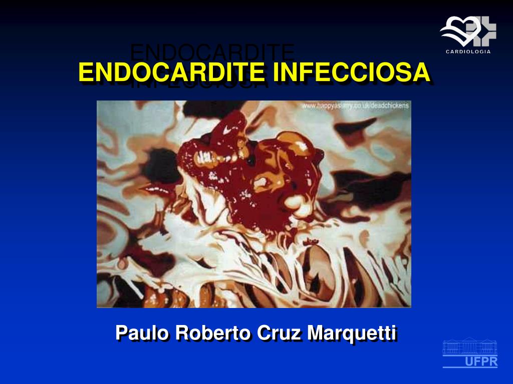 PPT - ENDOCARDITE INFECCIOSA PowerPoint Presentation, free download ...
