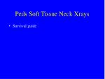 PPT - Soft tissue neck PowerPoint Presentation, free download - ID:6753069