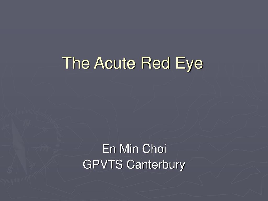 PPT - The Acute Red Eye PowerPoint Presentation, free download - ID:3563960