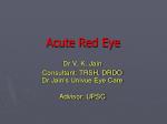PPT - RED EYE PowerPoint Presentation, free download - ID:4462254