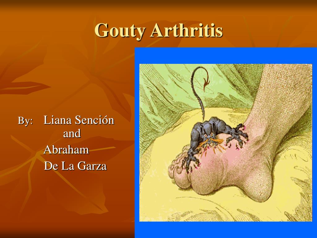 PPT - Gouty Arthritis PowerPoint Presentation, free download - ID:3568652