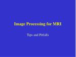 PPT - Image Processing for MRI PowerPoint Presentation, free download ...