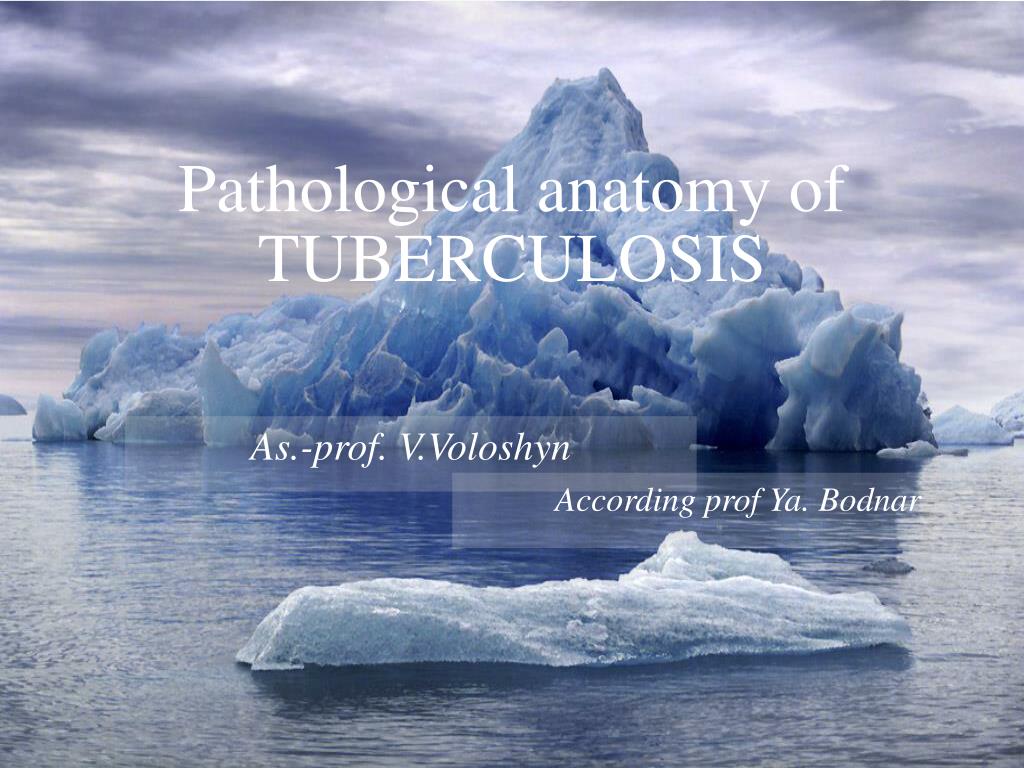 PPT - Pathological anatomy of TUBERCULOSIS PowerPoint Presentation ...